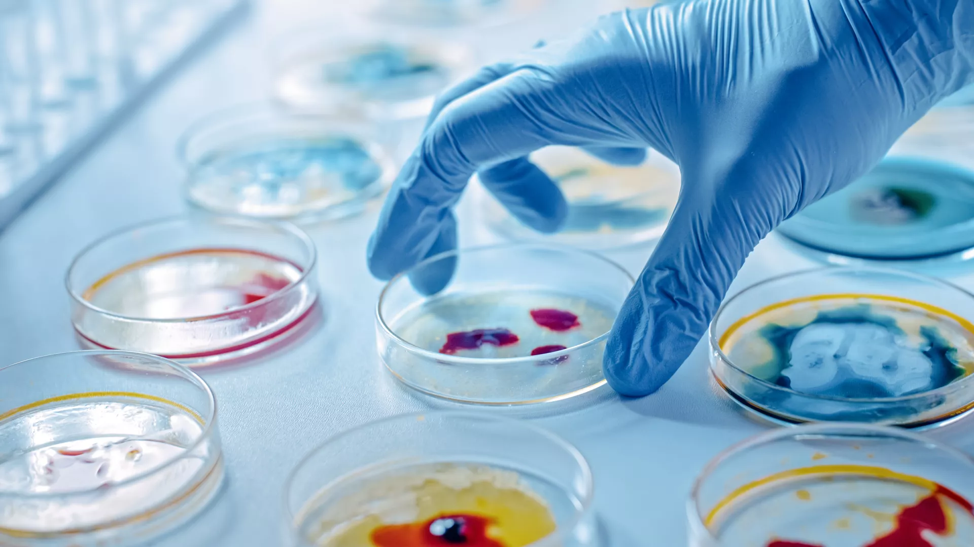 What Is Microbiological Risk Assessment [MRA] 2025? - Edubeas.com